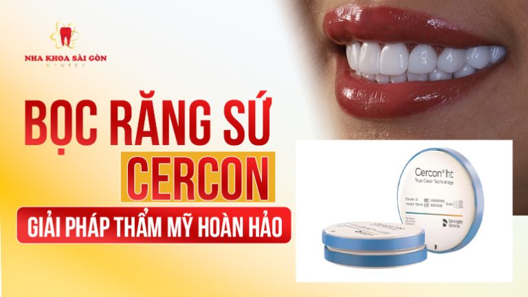 Khám Phá Răng Sứ Cercon Cho Nụ Cười Hoàn Hảo | Nha Khoa Sài Gòn Center